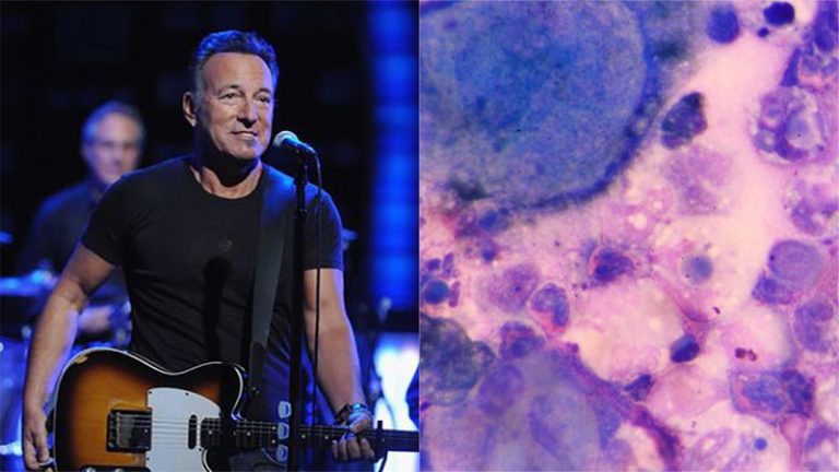 You’re A Germ! Can You Make Bruce Springsteen Sick Enough To Cancel A ...
