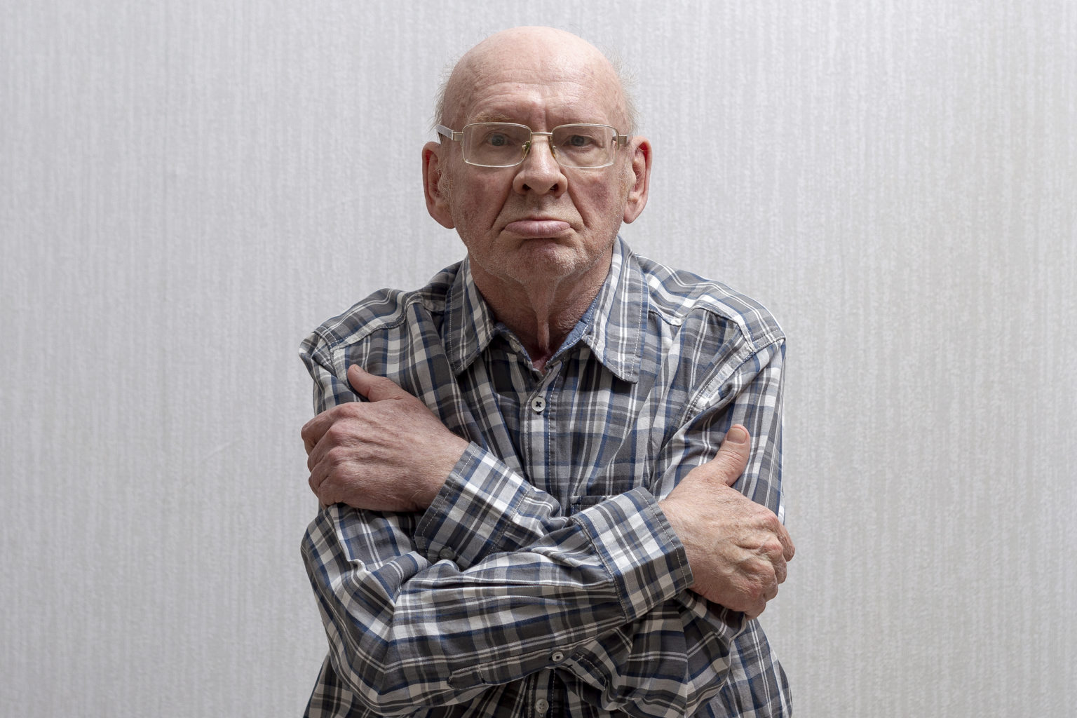 Powerful: These Photos Of Frowning Bald Men Are A Sobering Reminder ...