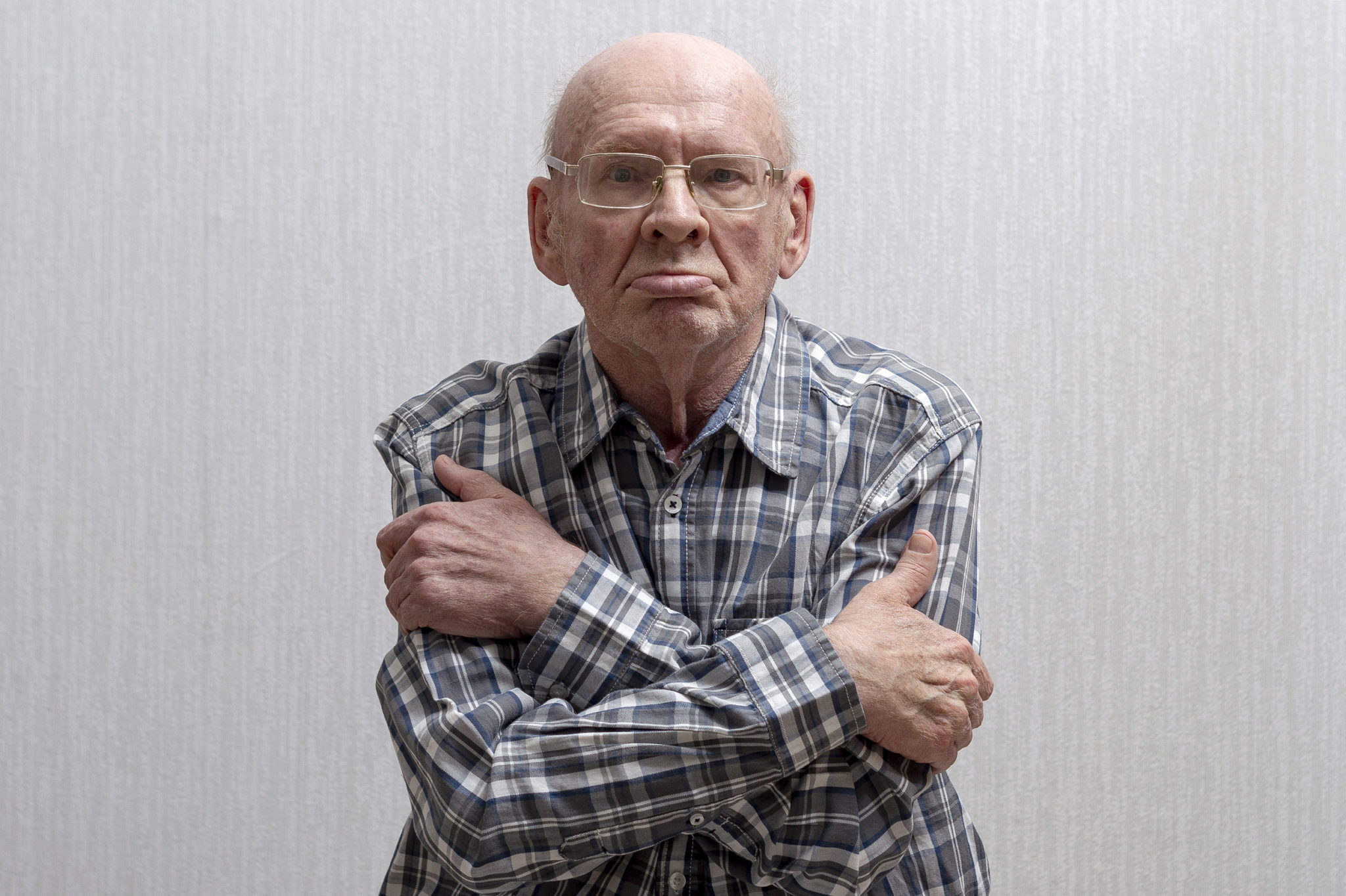 Powerful: These Photos Of Frowning Bald Men Are A Sobering Reminder ...