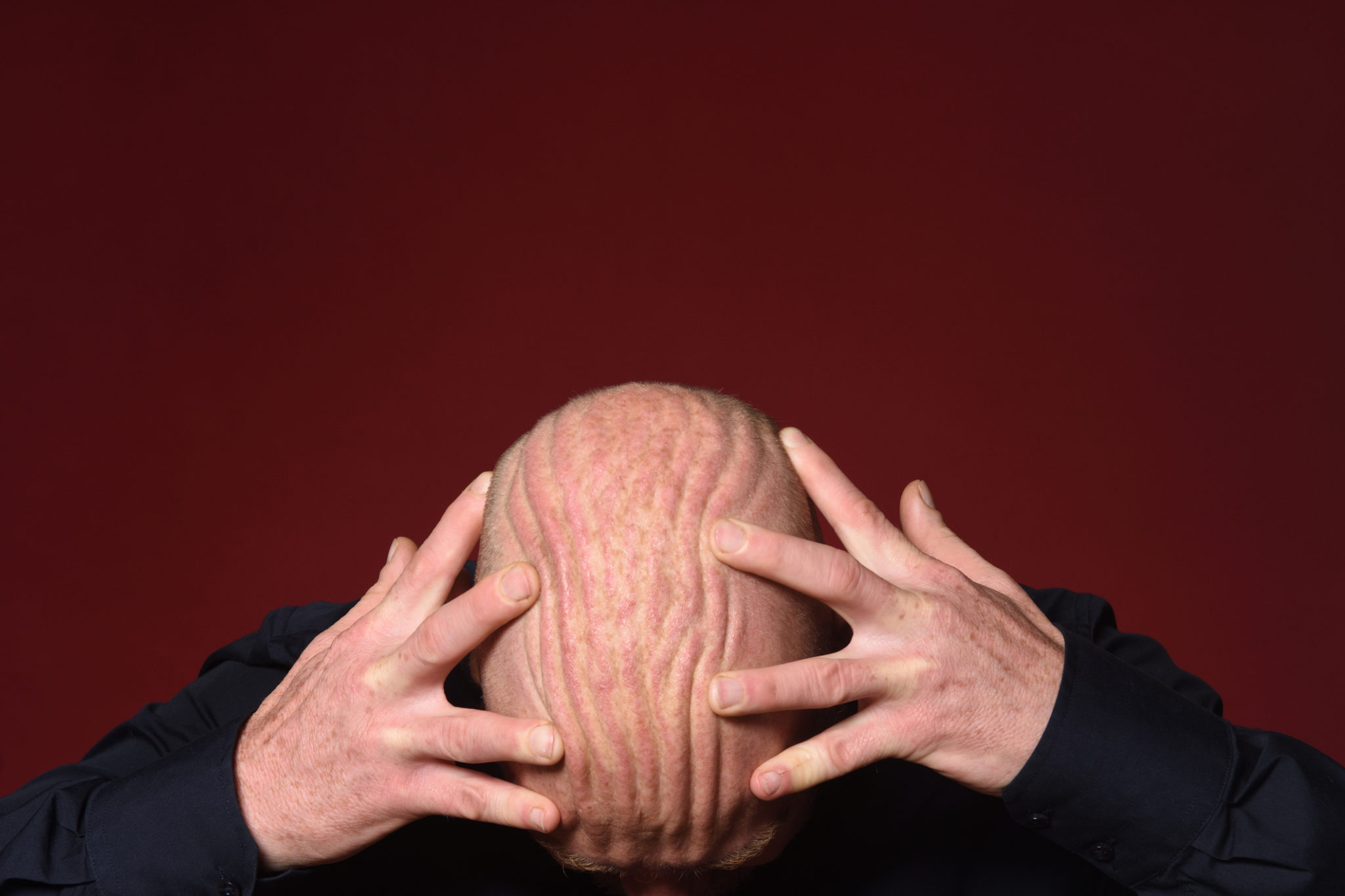 Powerful: These Photos Of Frowning Bald Men Are A Sobering Reminder ...